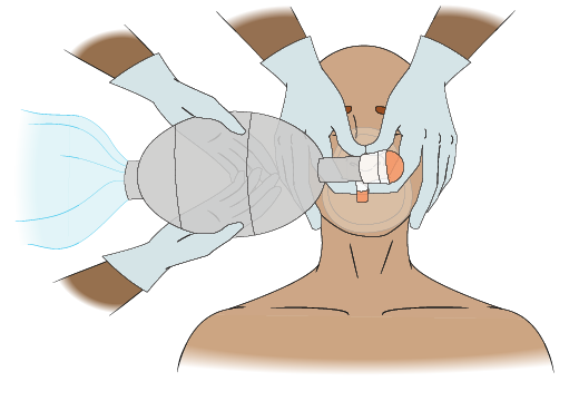 16.3 - Artificial Respiration (AR)