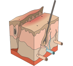 8.1 - Types of Minor Wounds